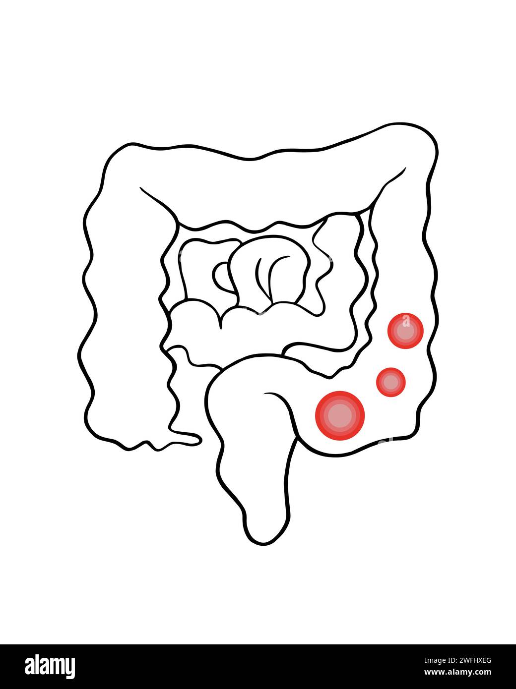 Vector illustration of human intestine.Constipation. Intestinal ...