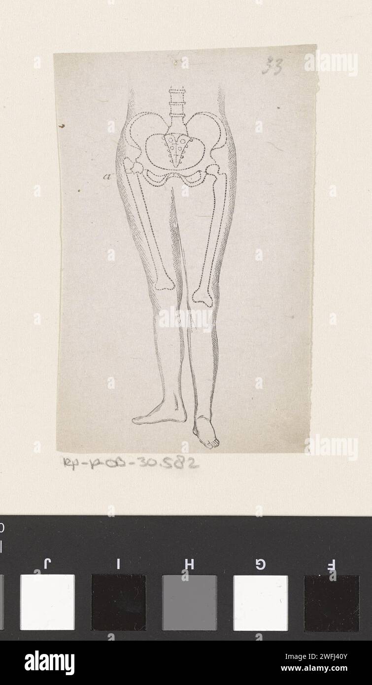 Human Pelvis with a fracture in the bone, Isaac Weissenbruch, 1836 ...
