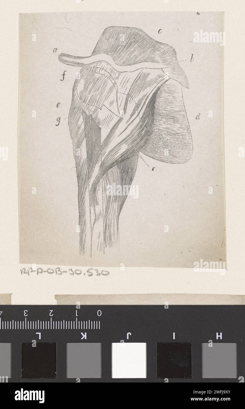 Part of the human body with a deviation, Isaac Weissenbruch, 1836 ...