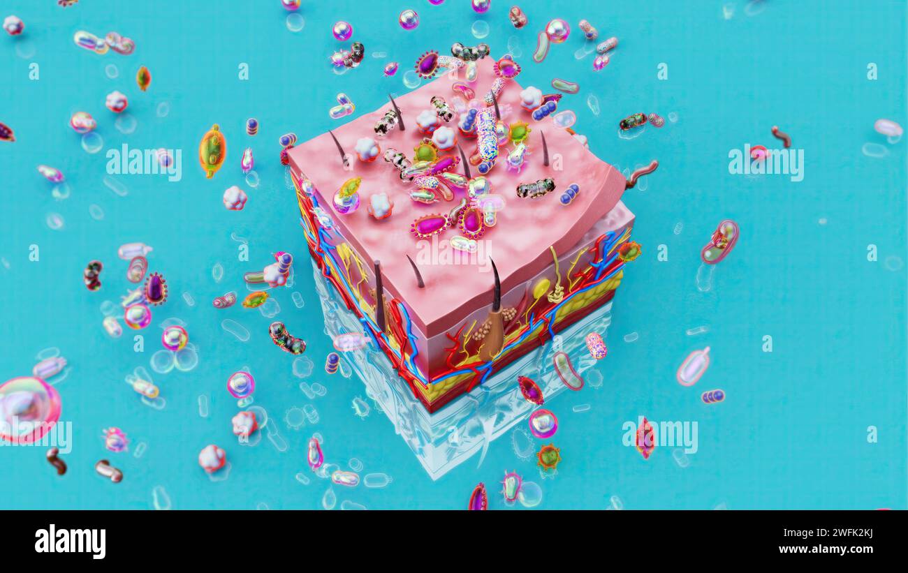 Cellulitis bacteria hi-res stock photography and images - Alamy