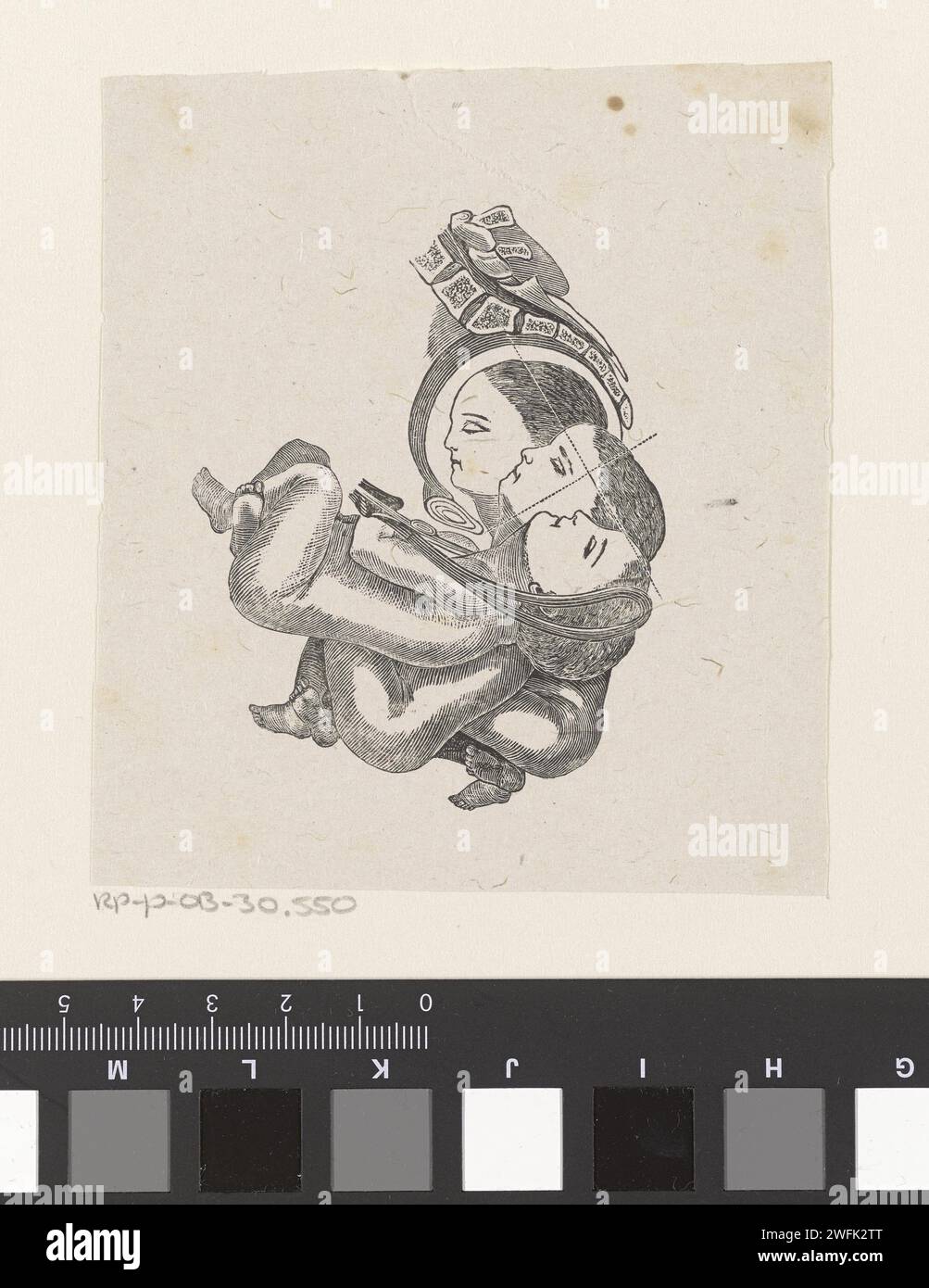 Turning a fetus in the womb towards the end of pregnancy, Isaac ...