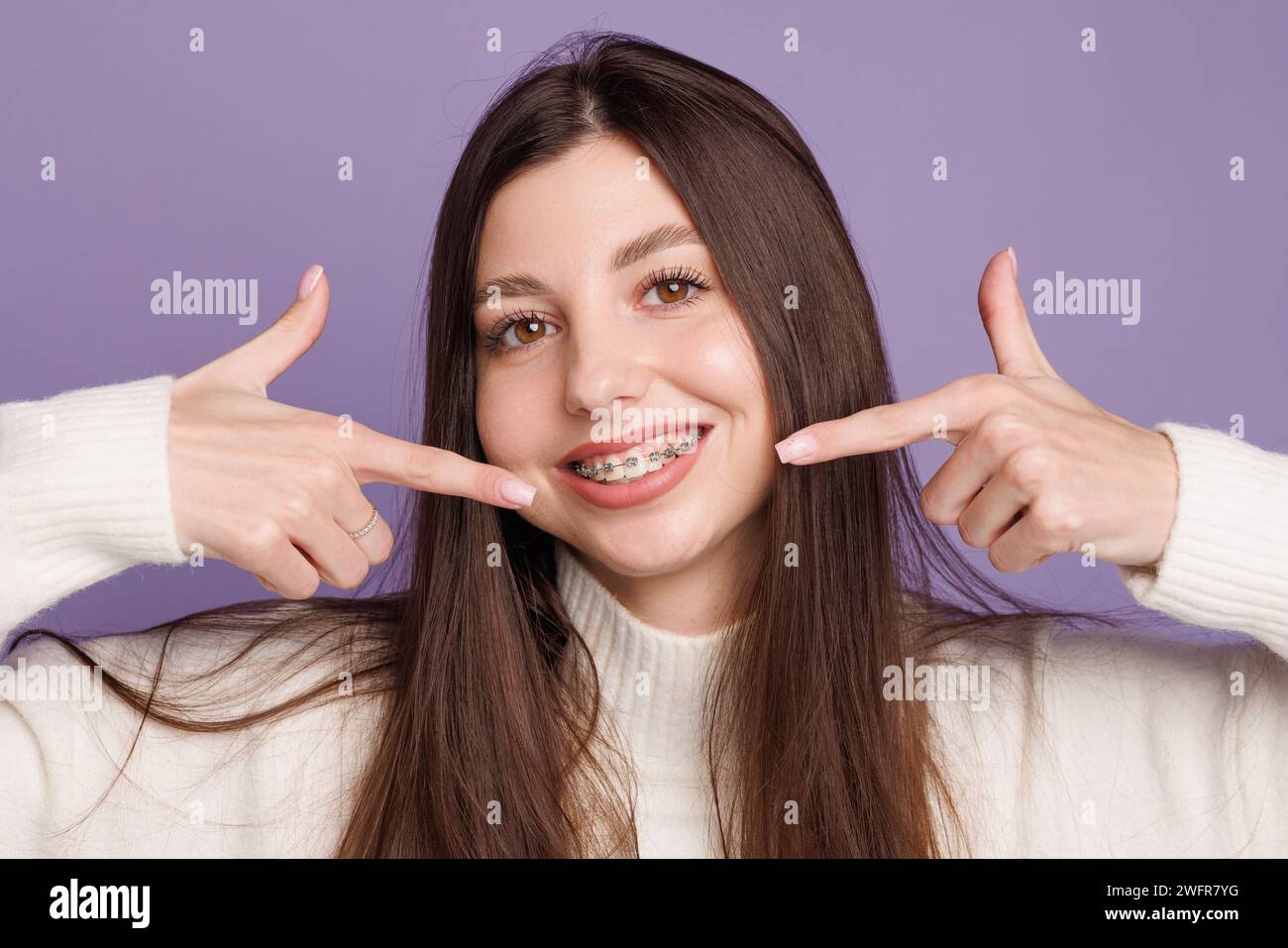 portrait of a girl with braces, woman happy with braces shows ok sign ...