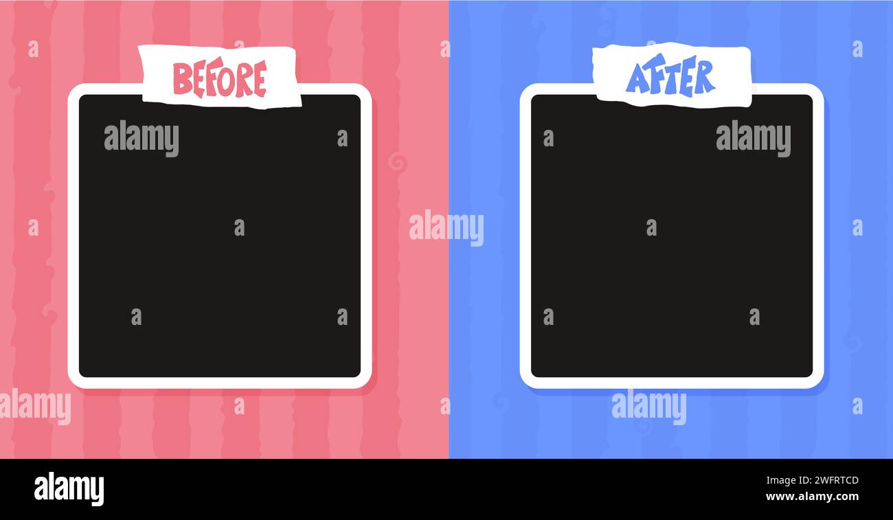 Before and After template. Vector illustration Stock Vector Image & Art ...