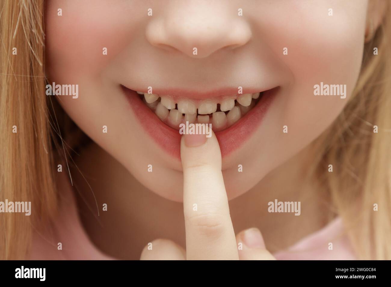 Cute preschool girl showing a loose primary (baby) tooth Stock Photo ...