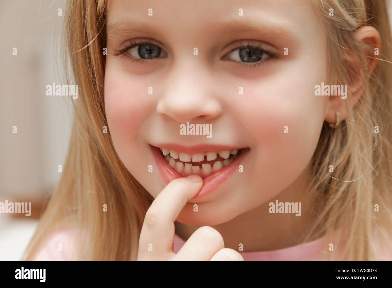 Cute preschool girl showing a loose primary (baby) tooth Stock Photo ...