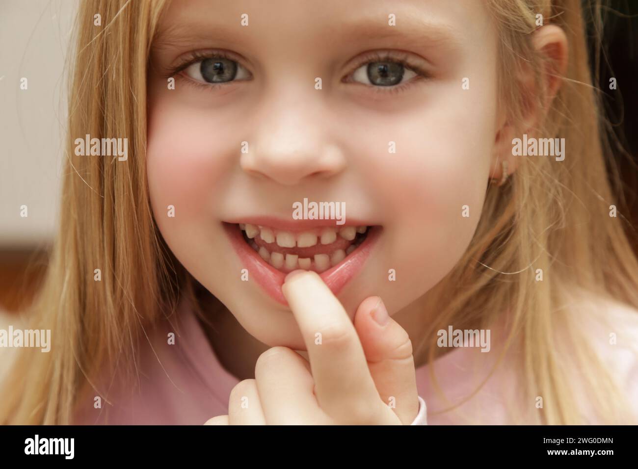 Cute preschool girl showing a loose primary (baby) tooth Stock Photo ...