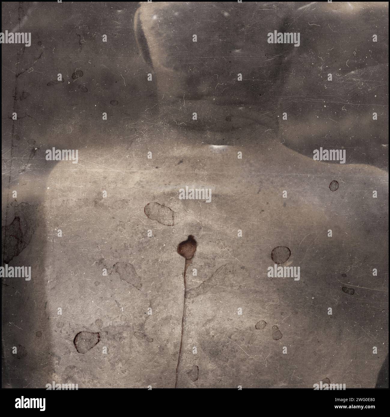 Wound is seen in the back of a dead body Stock Photo - Alamy