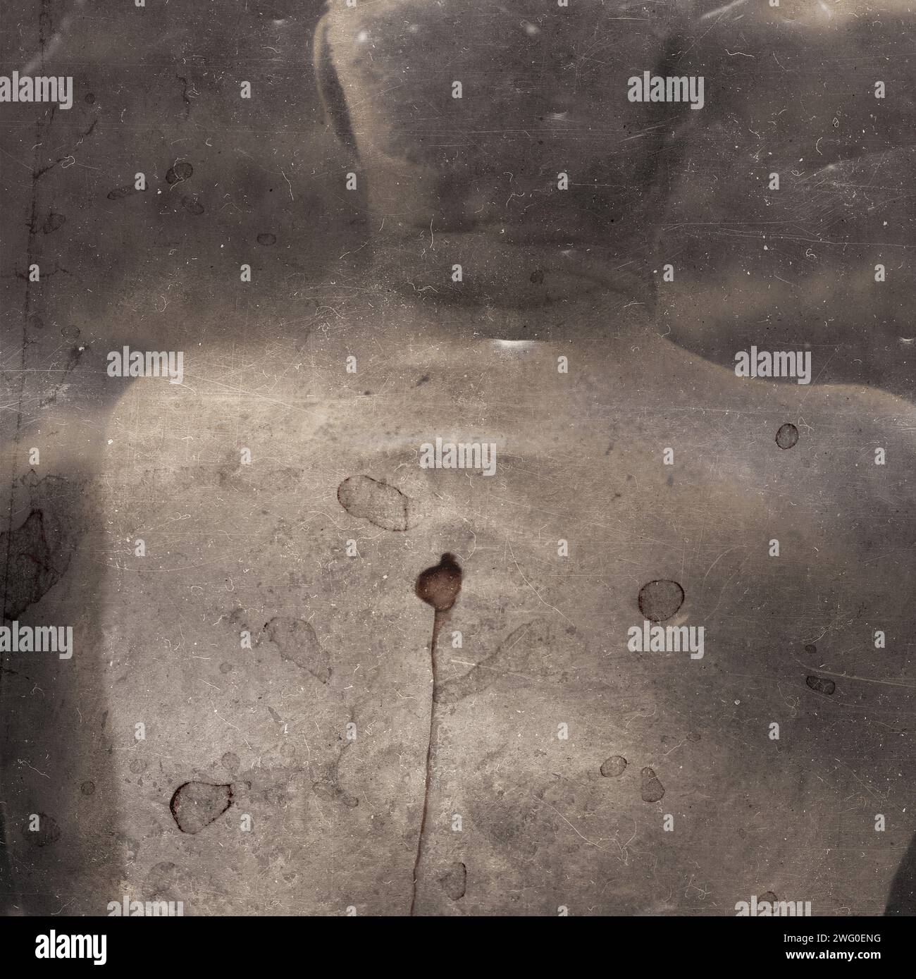 Dripping wound on man's back. (Distressed Stock Photo - Alamy