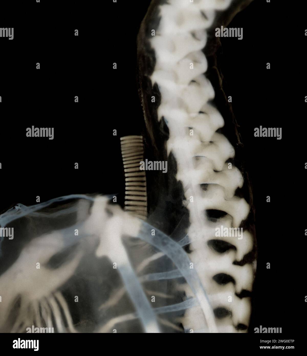 Microscopic view of a fetal chick skeleton Stock Photo - Alamy