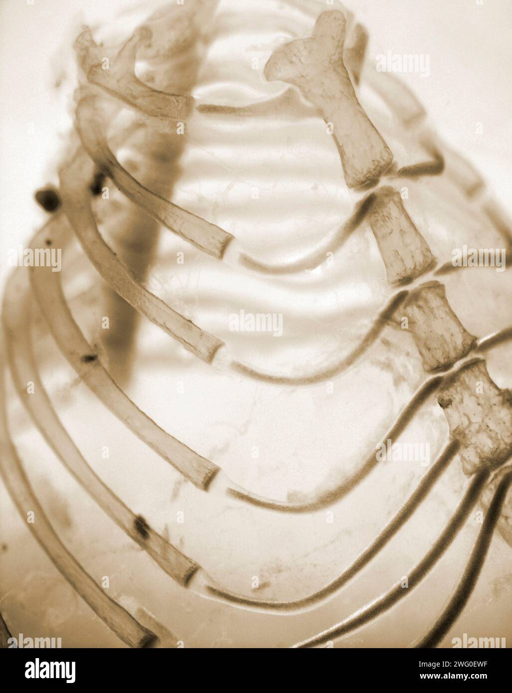 Fetal image hi-res stock photography and images - Alamy