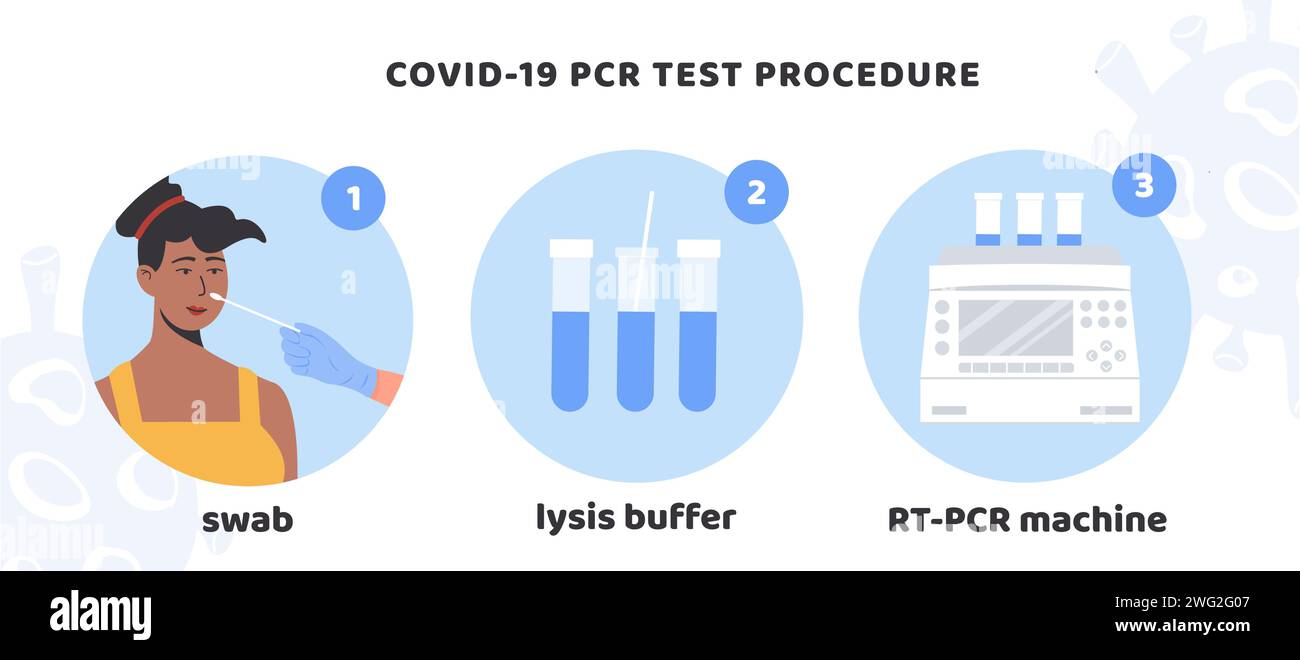 Covid-19 PCR test procedure. A doctor in latex gloves takes nasal swab ...