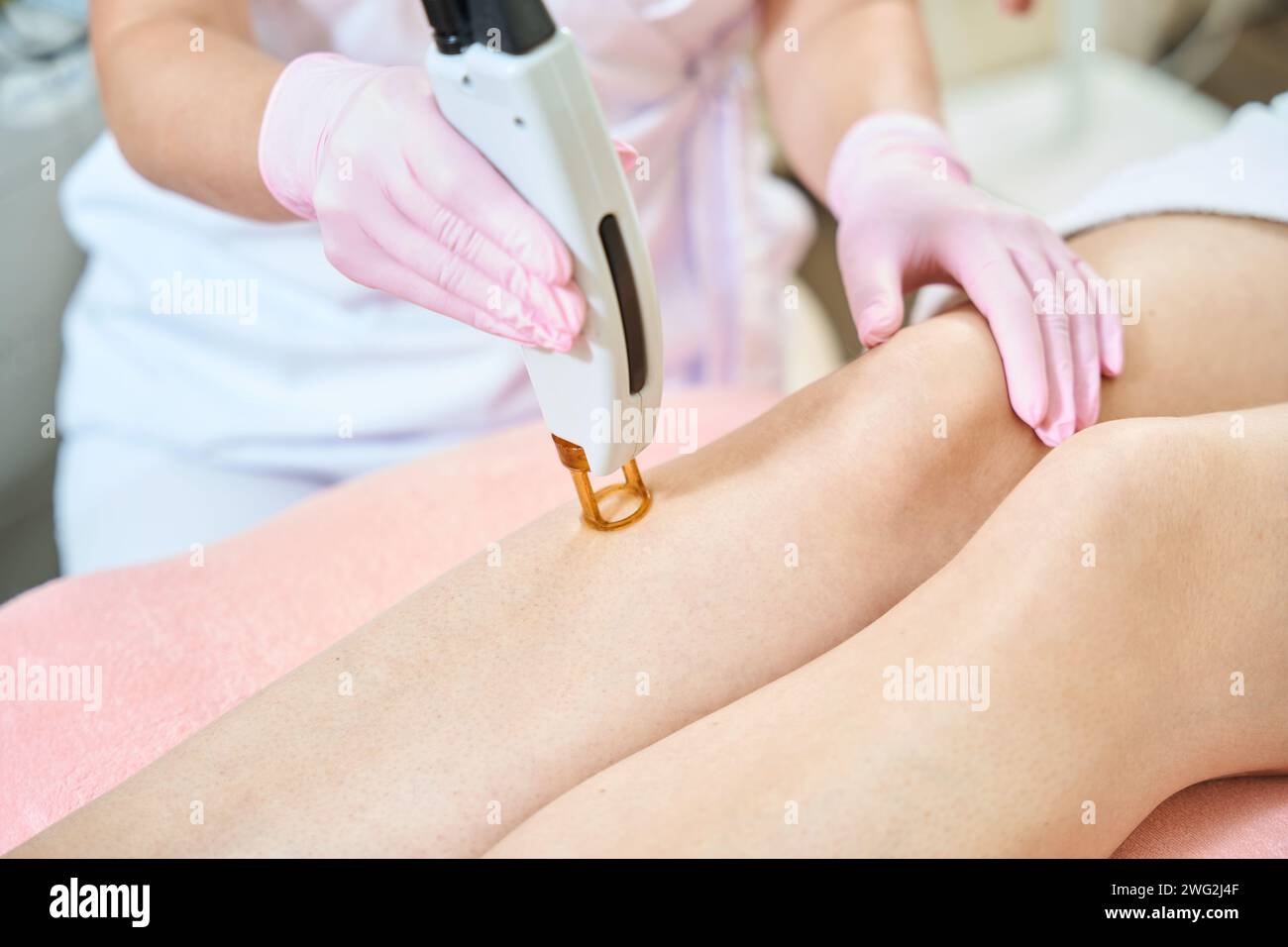 Beautician doing laser epilation with IPL photorejuvenation device of ...
