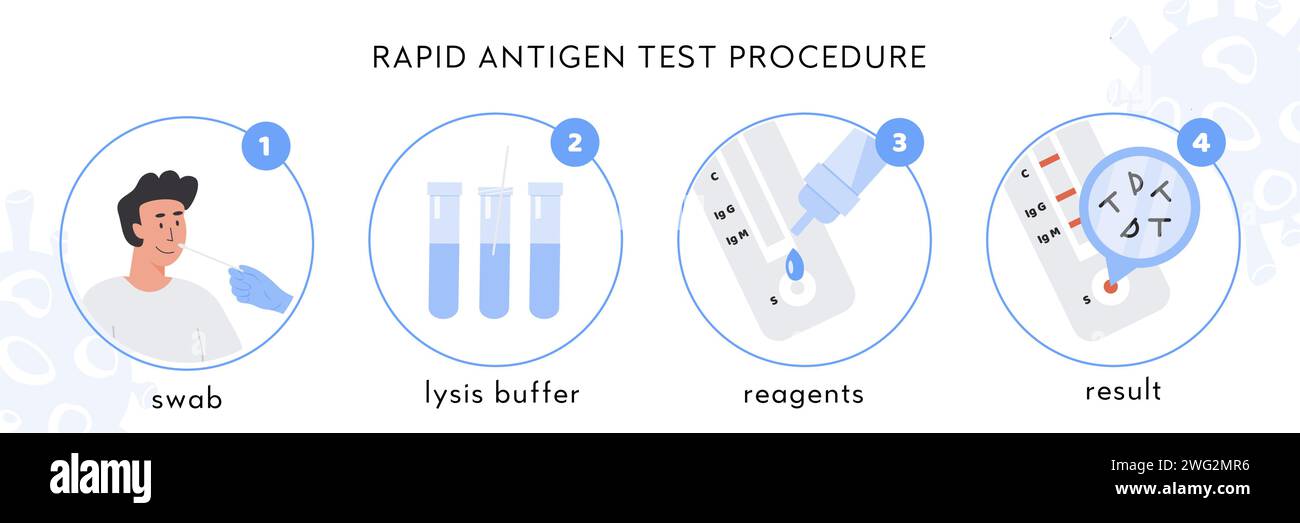 Covid-19 Rapid Antigen test procedure Infographic. A doctor takes nasal ...