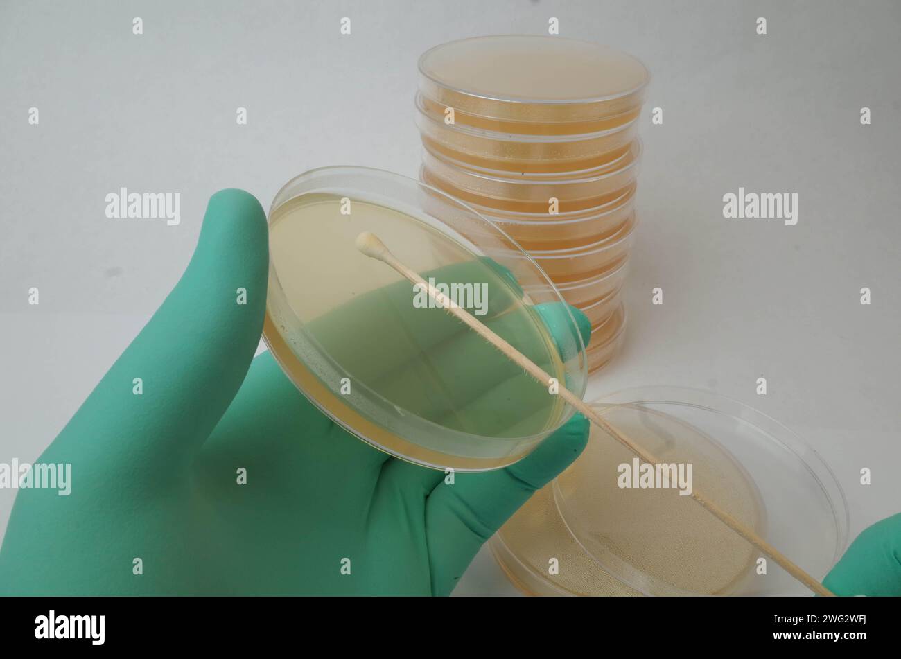 Microbiological culture hi-res stock photography and images - Alamy