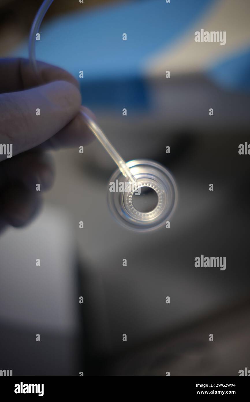 photo of suction cup of the femtosecond keratome on the smile lasik ...