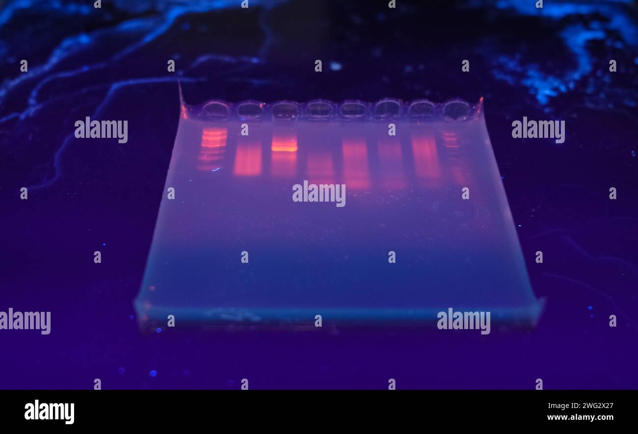 Agarose gel electrophoresis hi-res stock photography and images - Alamy