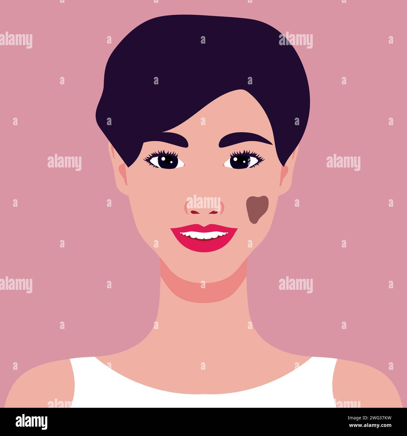 Beautiful smiling young woman with a birthmark on her face. Rare ...