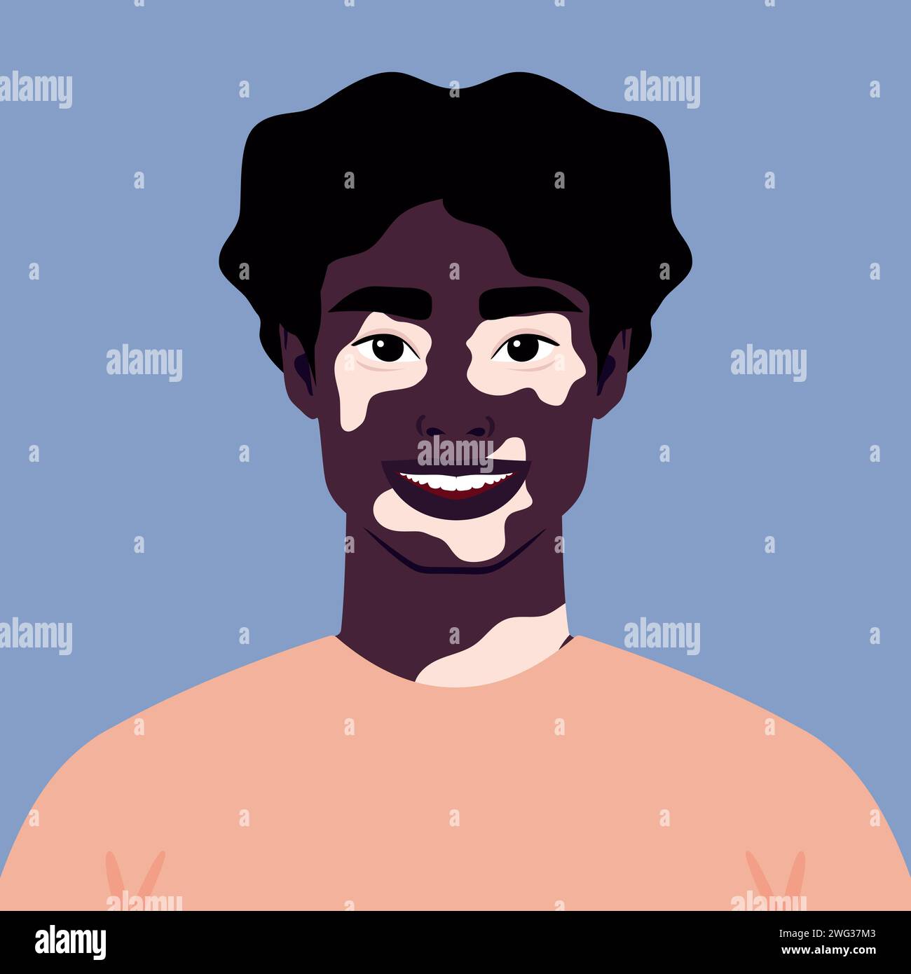 African young man with vitiligo depigmentation. Rare appearance. Portrait or an avatar. Vector ...