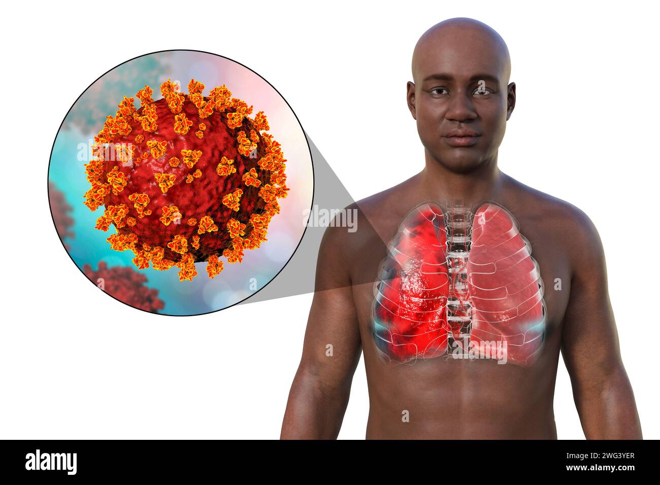 Illustration showing the upper half of a man with transparent skin ...