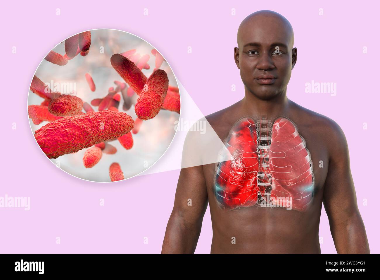 Illustration showing the upper half of a man with transparent skin ...