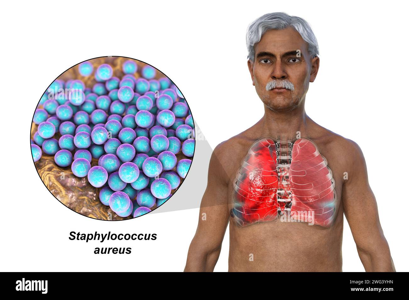 Illustration showing the upper half of a man with transparent skin ...