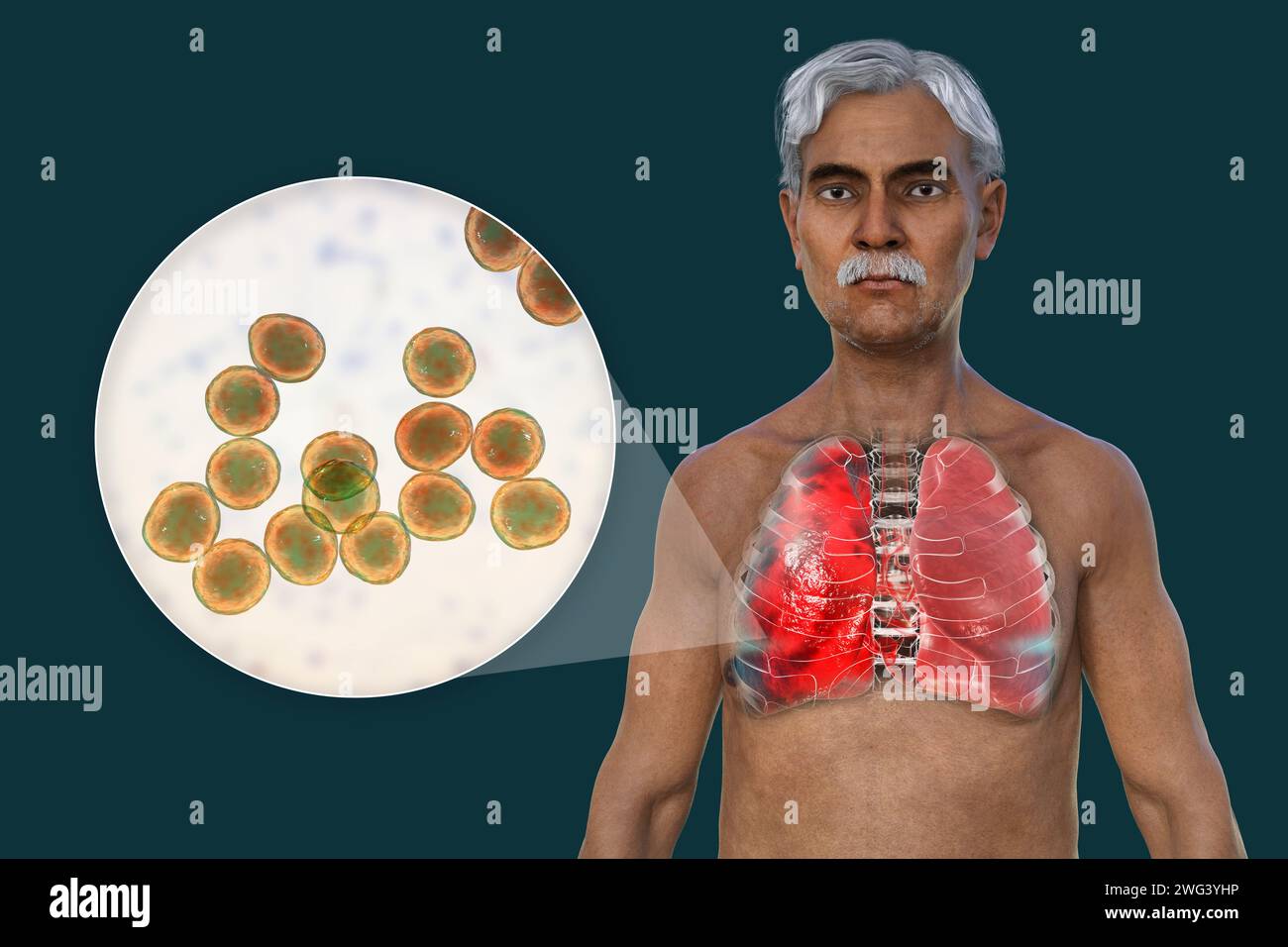 Illustration showing the upper half of a man with transparent skin ...