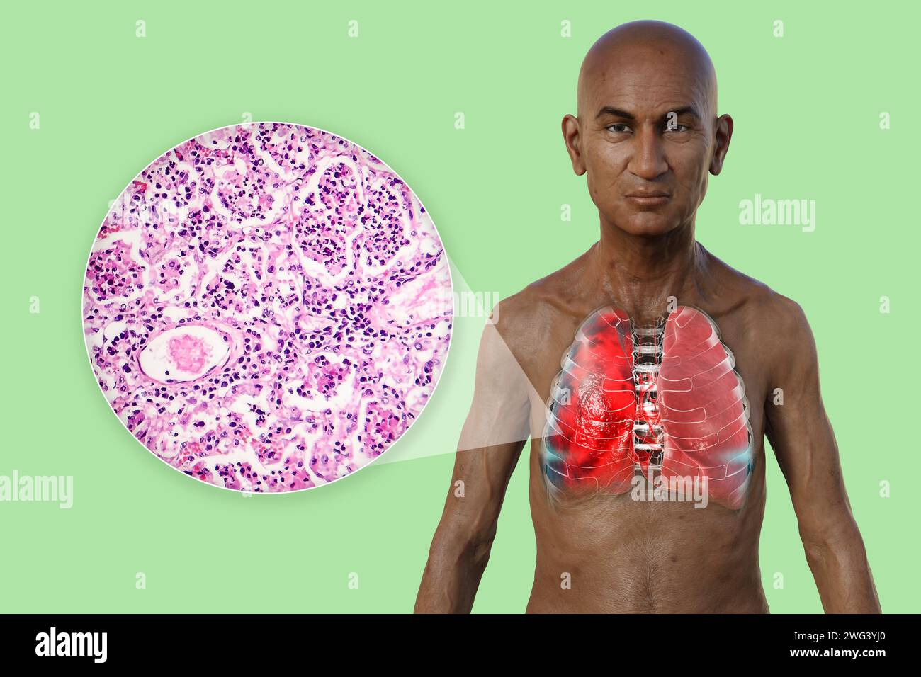 Illustration showing the upper half of a man with transparent skin ...