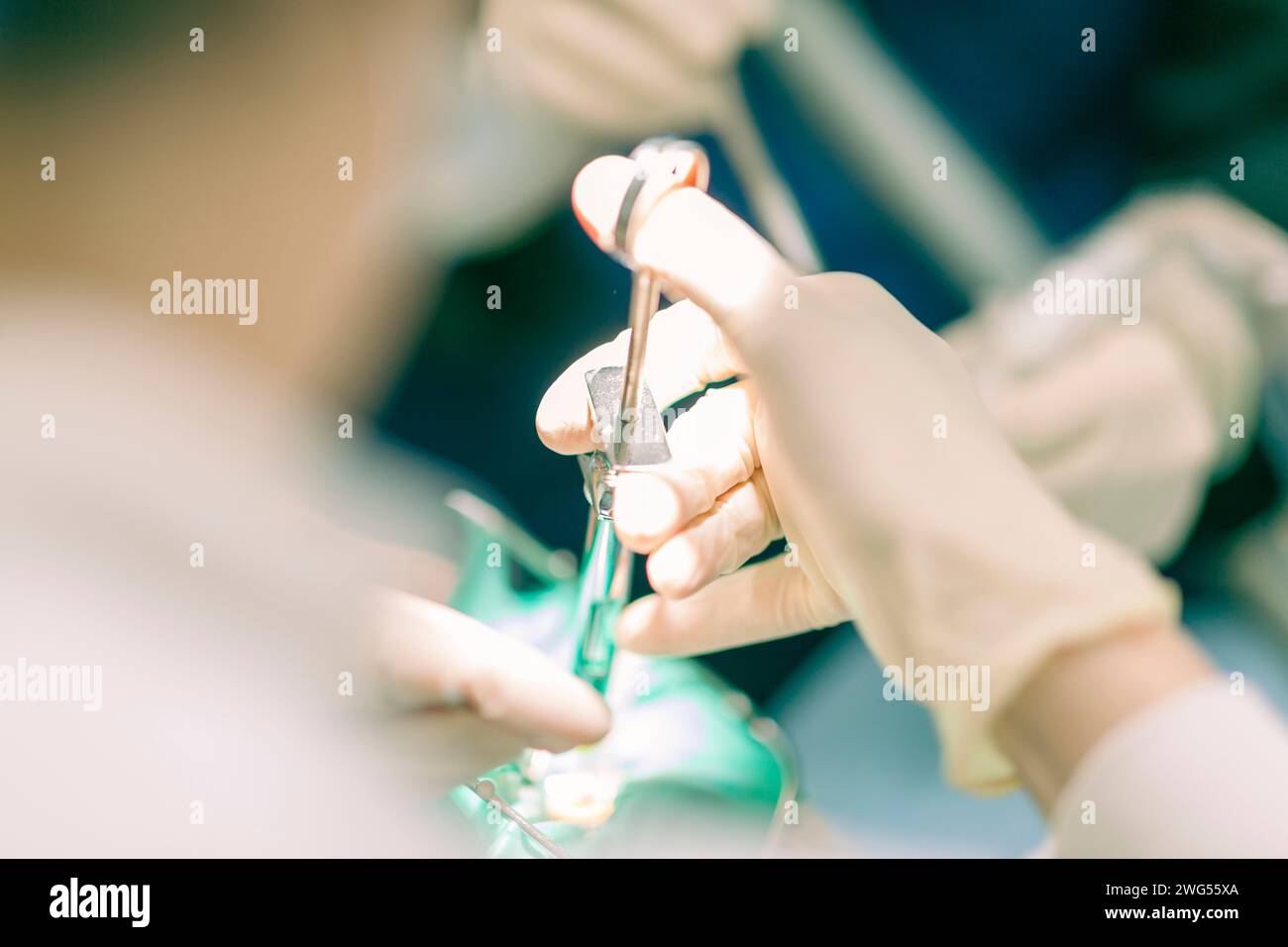 Detail of a dentist performing surgery with anesthesia on a patient for ...