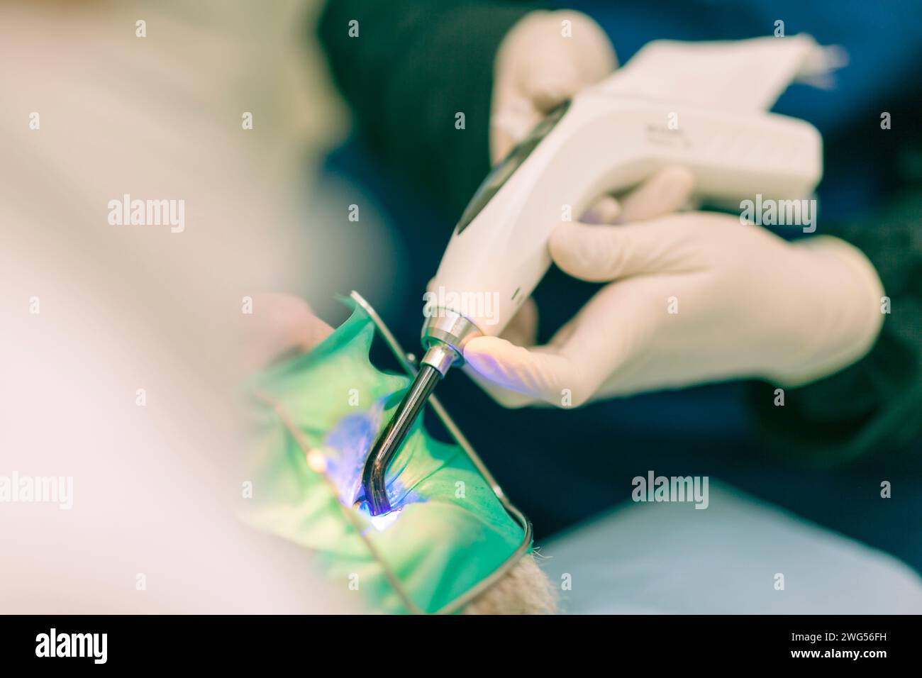 Detail of a dentist performing surgery with anesthesia on a patient for ...