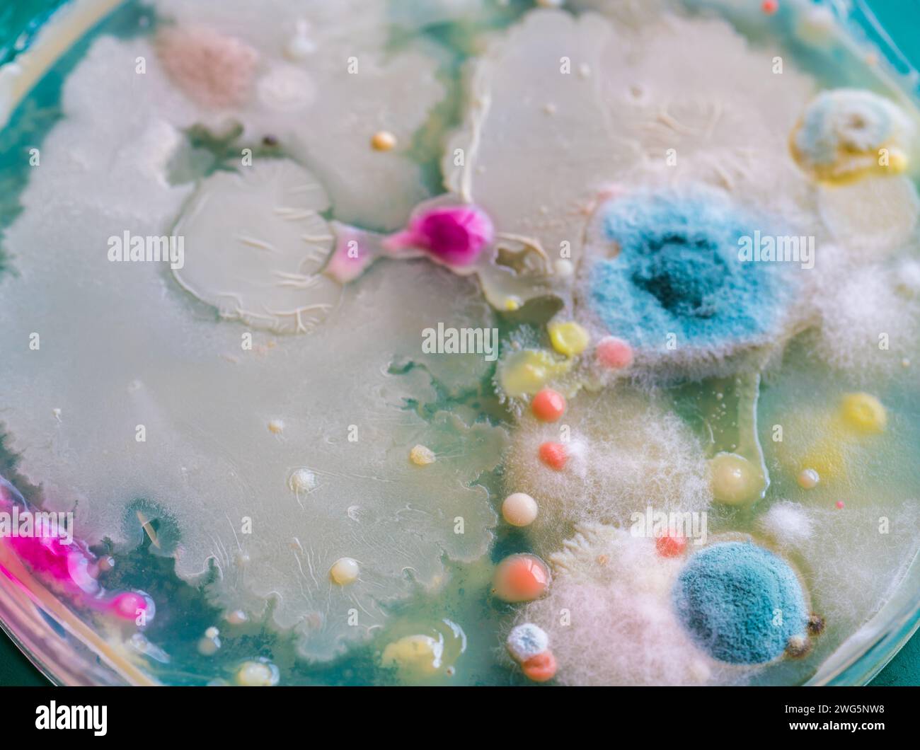colonies of bacteria and other microorganisms in a Petri dish on the ...