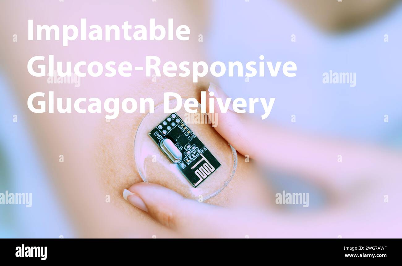 Implantable glucose-responsive glucagon delivery systems: Devices that ...