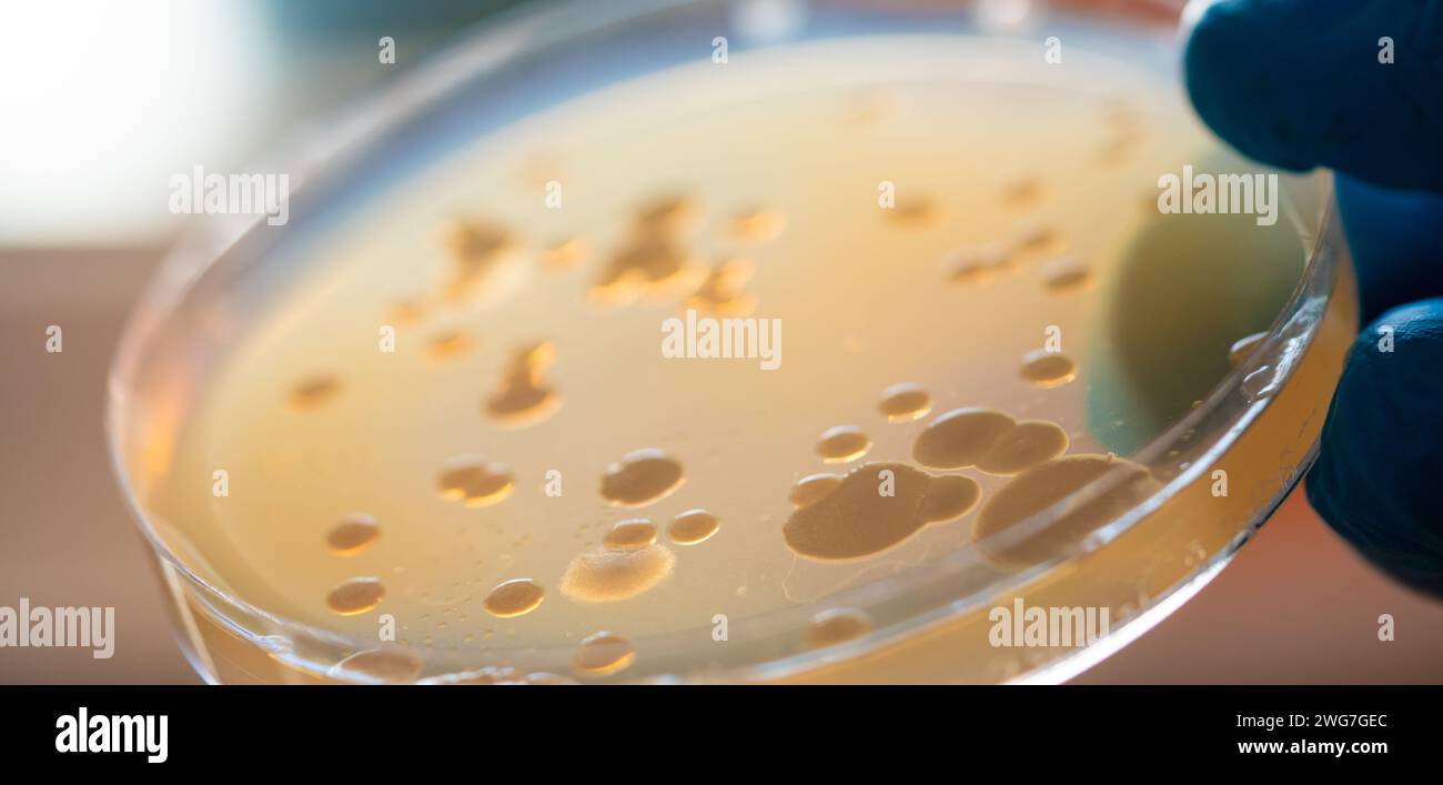 colonies of bacteria and microorganisms on the surface of agar and wind ...