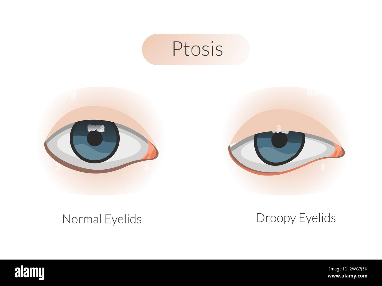Corrective marking Cut Out Stock Images & Pictures - Alamy
