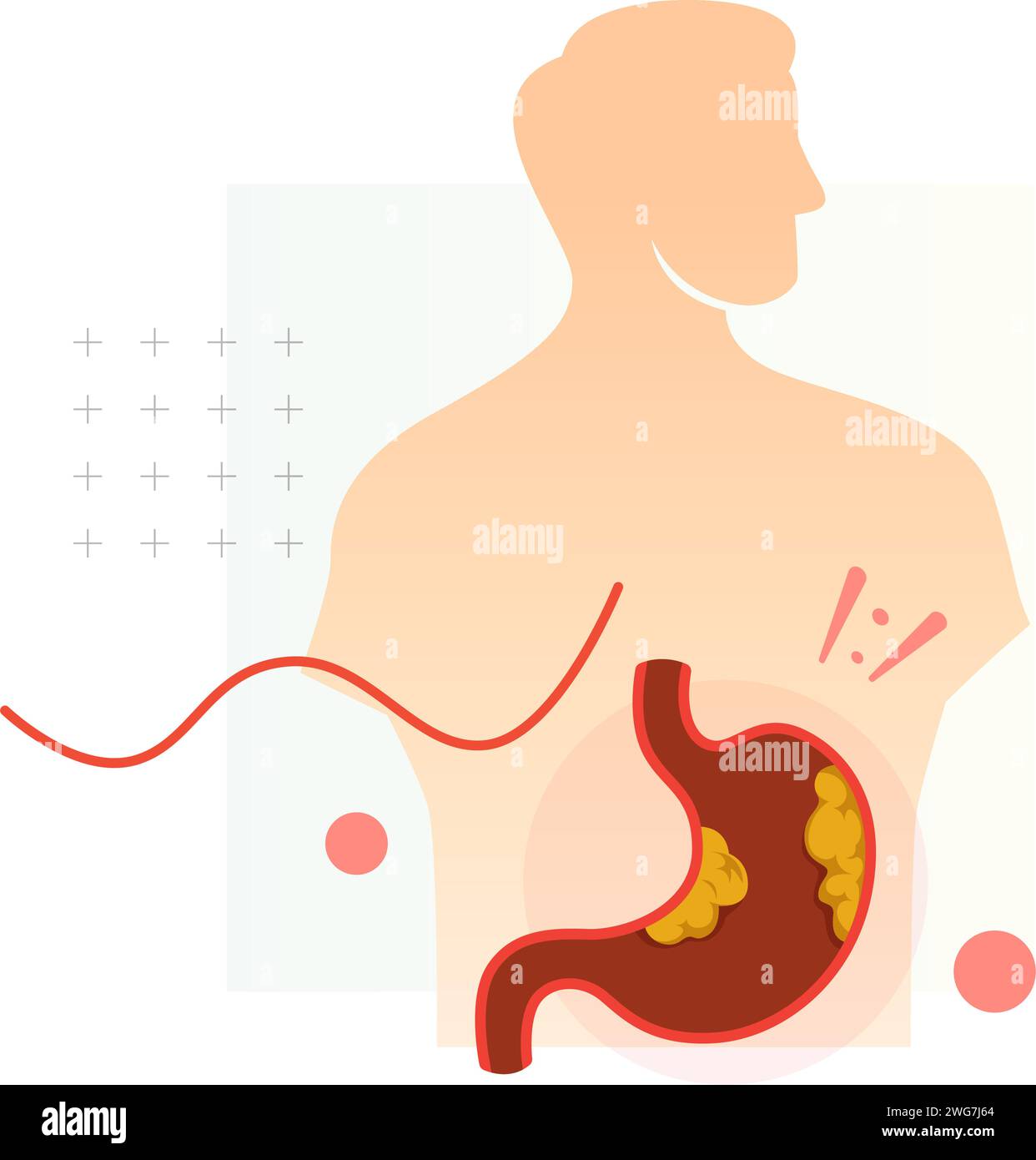 Stomach cancer doctor Cut Out Stock Images & Pictures - Alamy