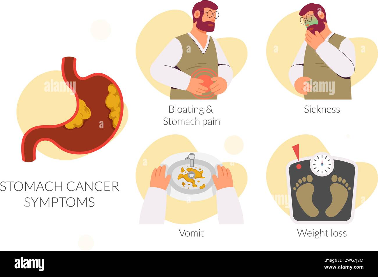 Gastric Cancer Signs