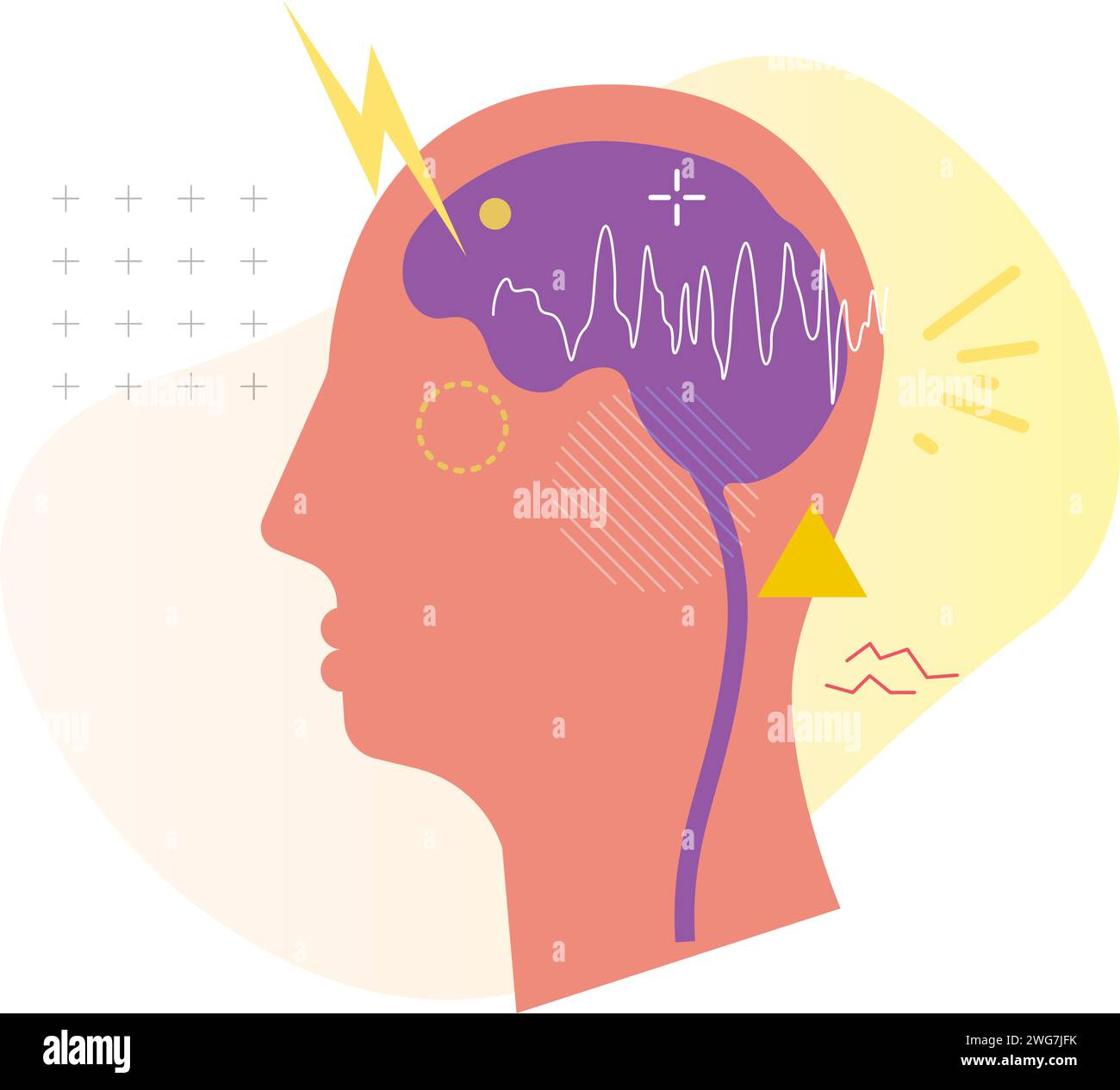 Epilepsy - A Neurological Condition - Stock Illustration as EPS 10 File ...