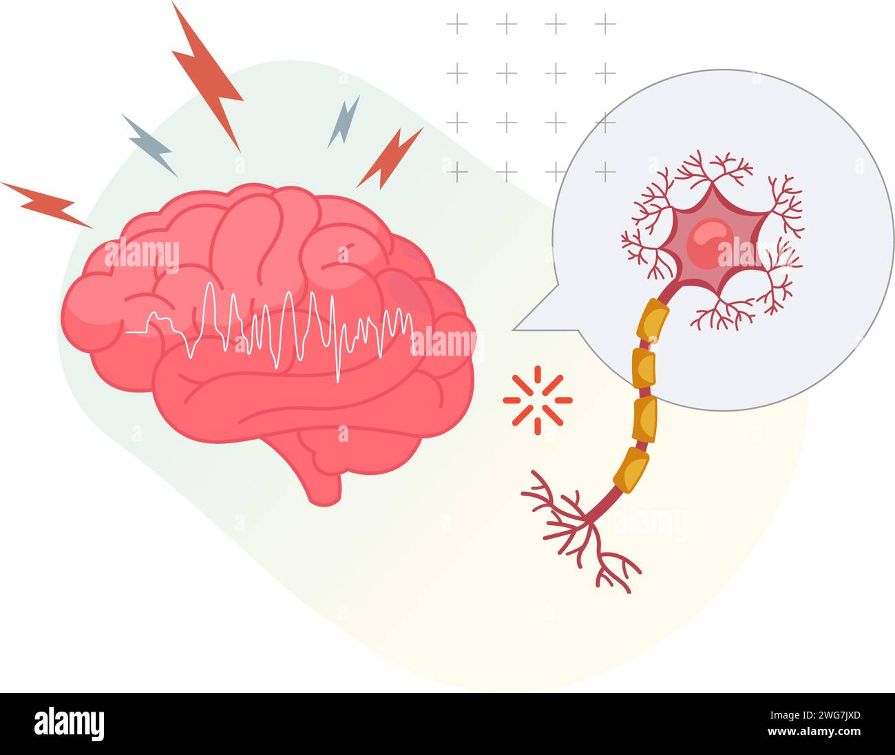 Epilepsy - A Neurological Condition - Stock Illustration as EPS 10 File ...