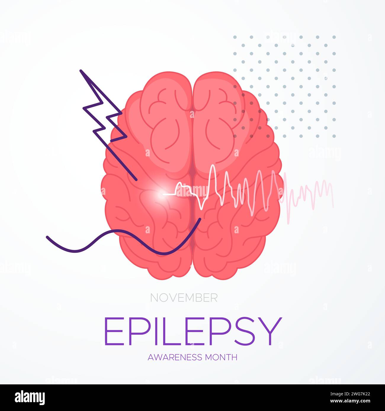 Epilepsy - A Neurological Condition - Stock Illustration as EPS 10 File ...