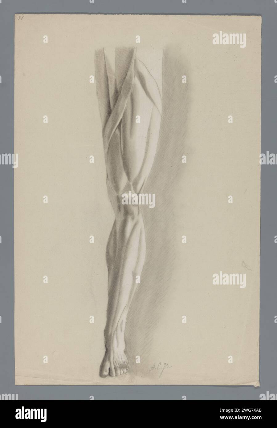 Anatomical gypsum model of a leg, Alexander Cranendoncq, after ...