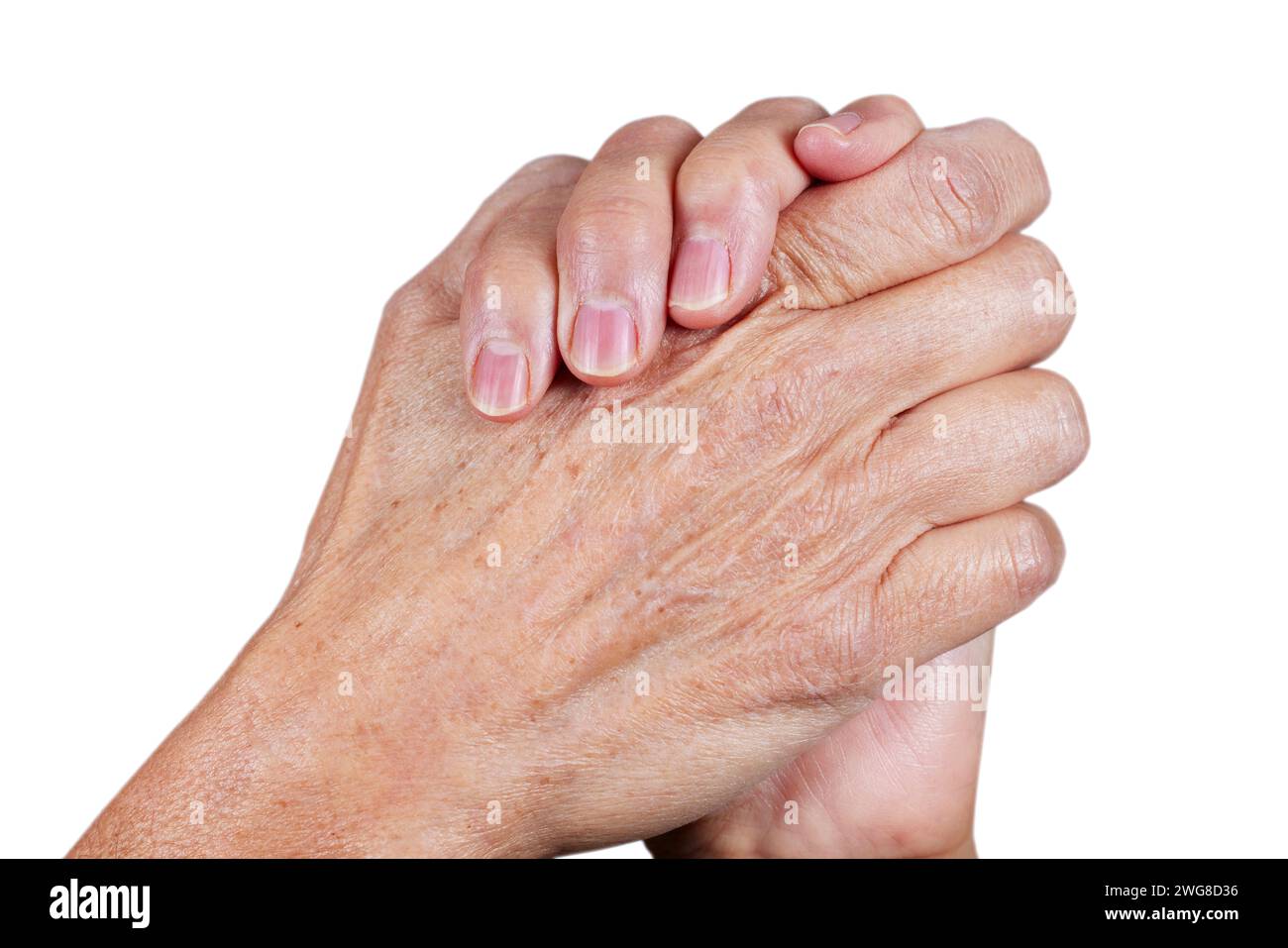 Clasped hands thumb hi-res stock photography and images - Alamy