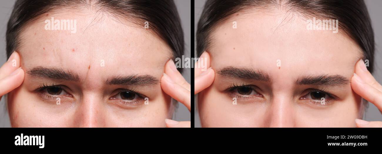 Aging skin changes. Woman showing face before and after rejuvenation ...