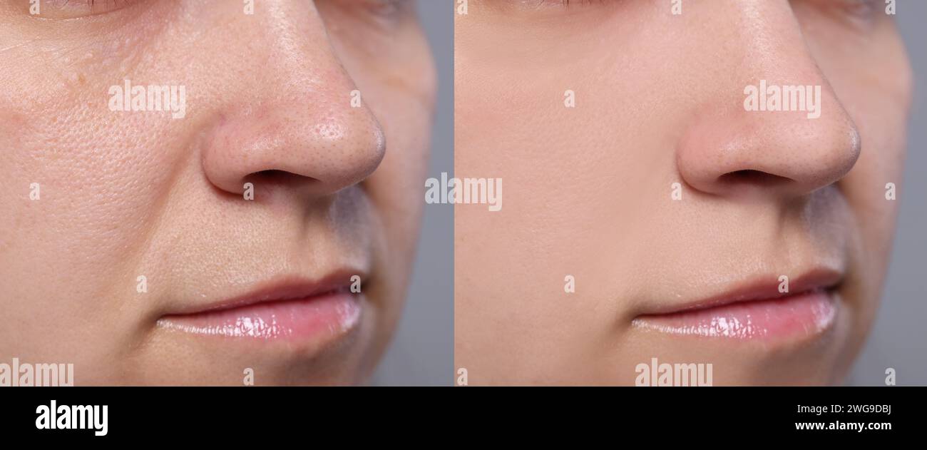 Aging skin changes. Woman showing face before and after rejuvenation ...