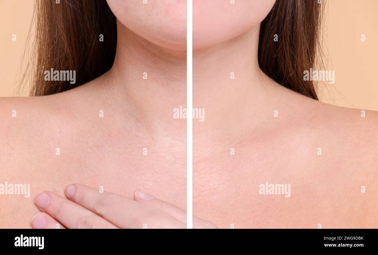 Sagging neck hi-res stock photography and images - Alamy