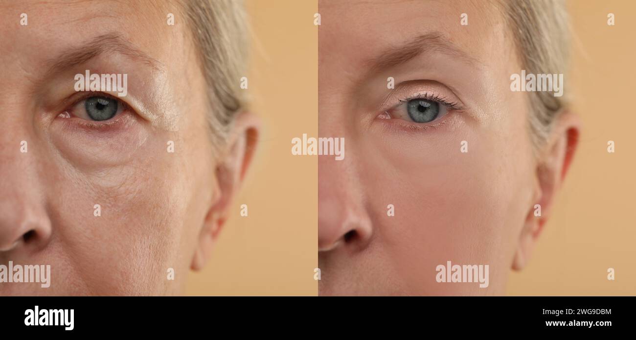 Aging skin changes. Woman showing face before and after rejuvenation ...