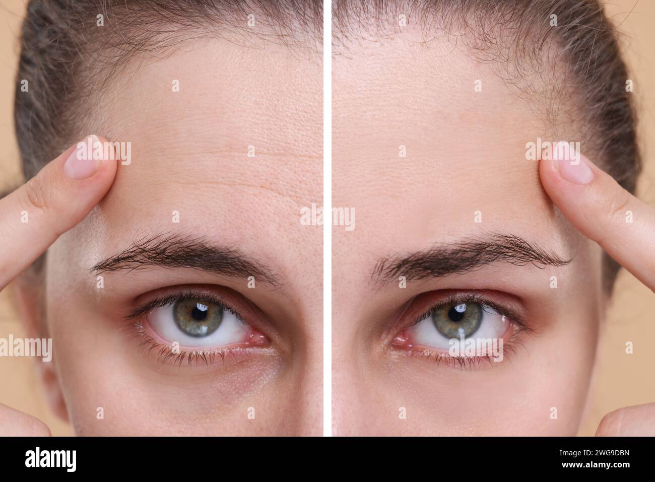 Aging skin changes. Woman showing face before and after rejuvenation ...