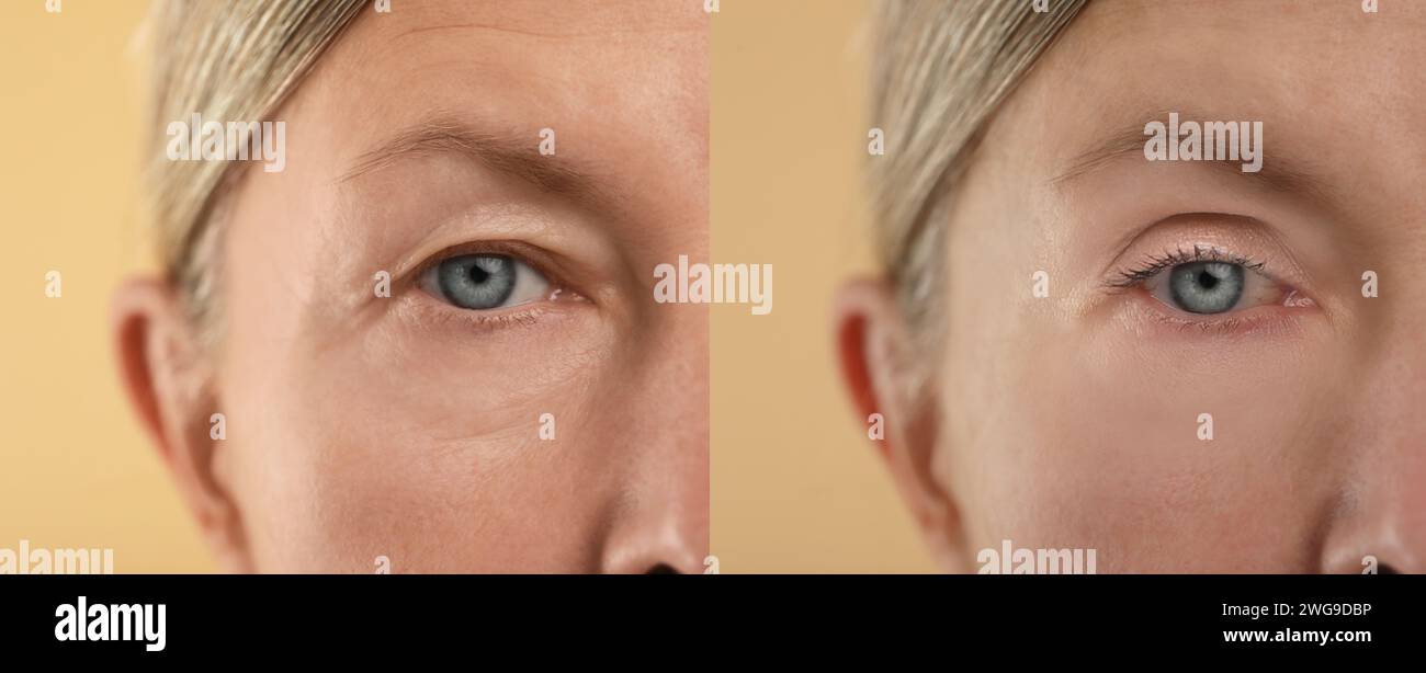 Aging skin changes. Woman showing face before and after rejuvenation ...