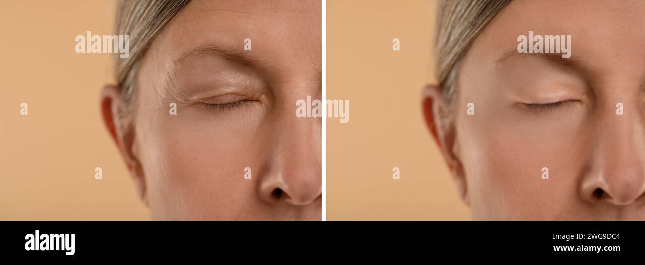 Aging skin changes. Woman showing face before and after rejuvenation ...