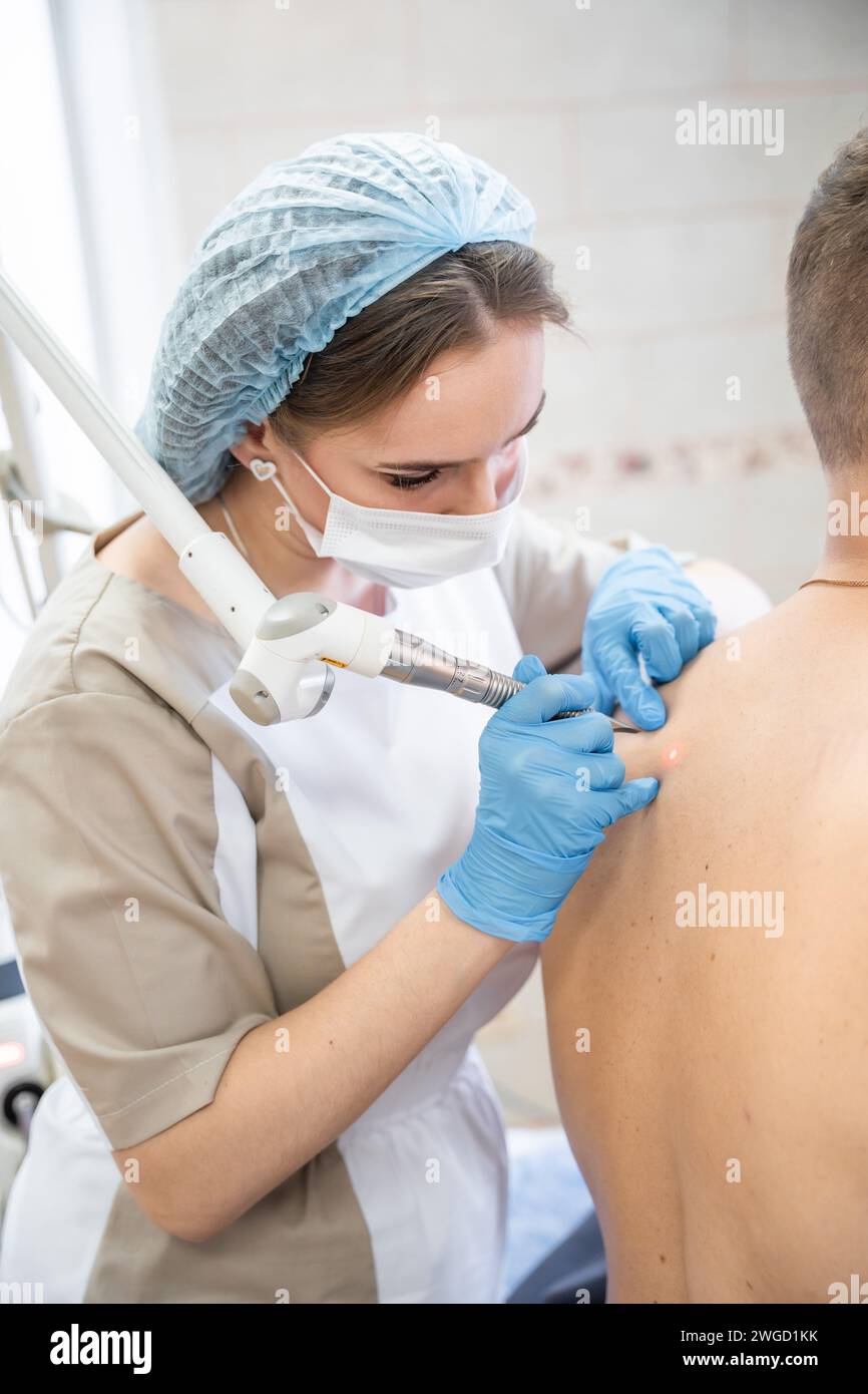 Dermatologist woman removes skin tumors with a laser, the process of ...