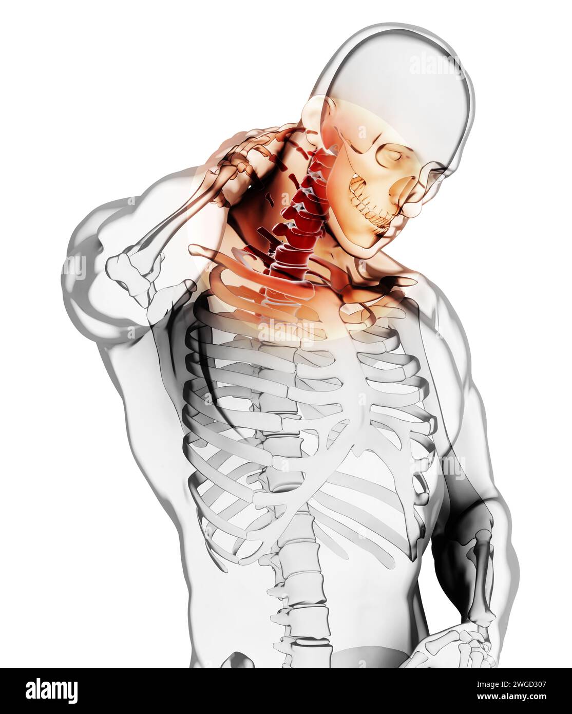 3D illustration, neck painful - cervical spine skeleton x-ray, medical ...
