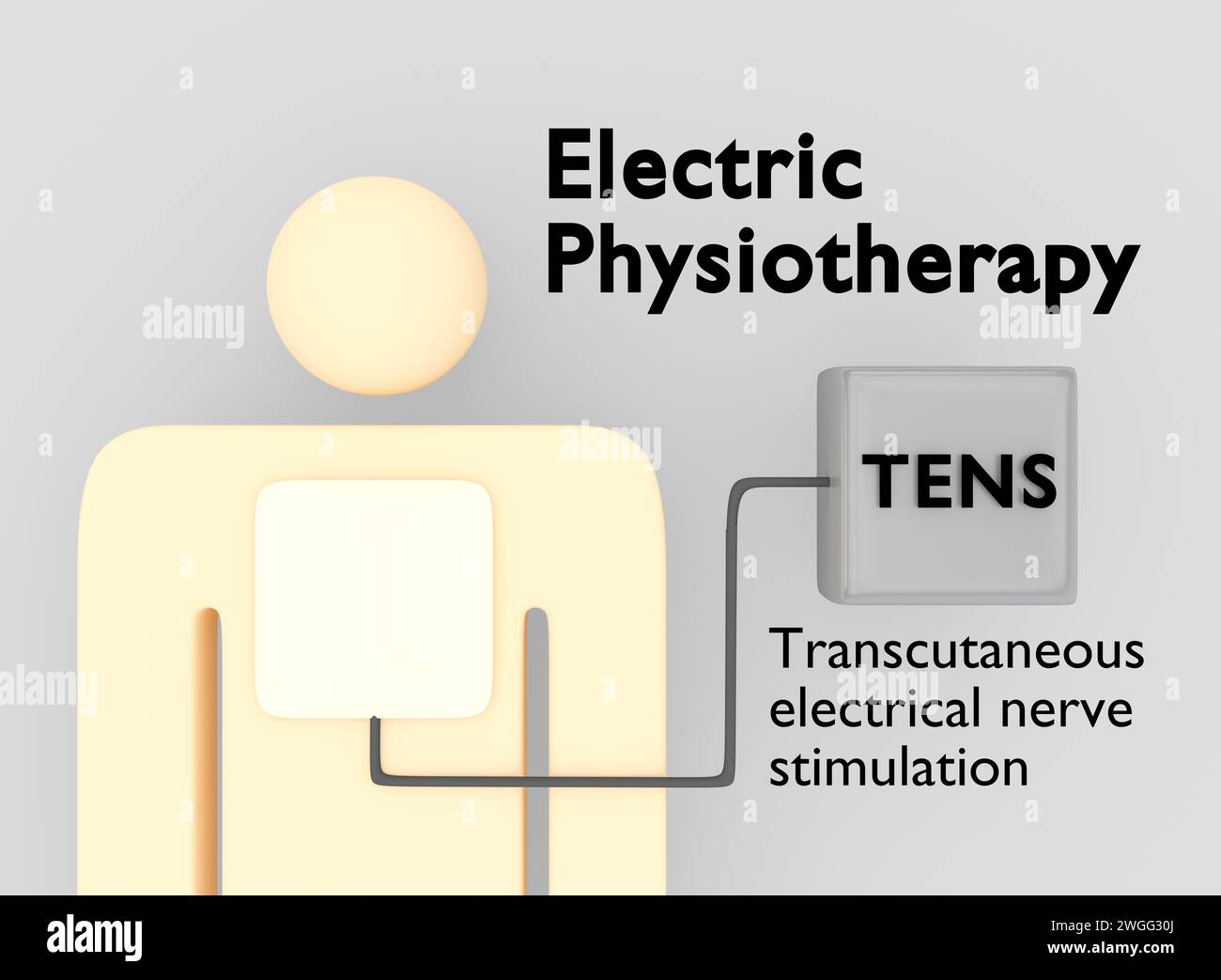 3D illustration of medical patch on a person chest, linked to a TENS device - transcutaneous ...